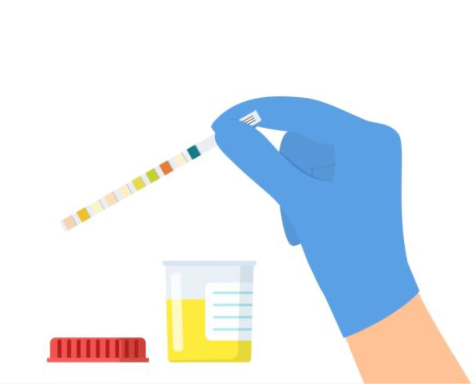 Urinary tract Infection – Southern Westchester Urology